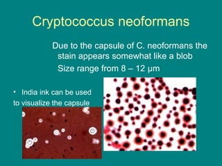 Gram Stains | PPT