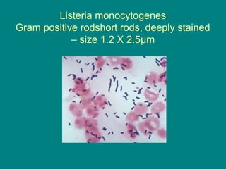 Gram Stains | PPT