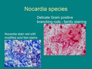 Gram Stains | PPT