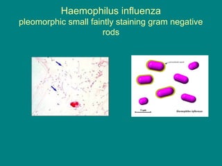 Gram Positive Pleomorphic Rods