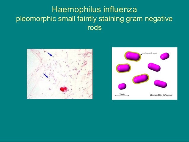 Gram Positive Pleomorphic Rods