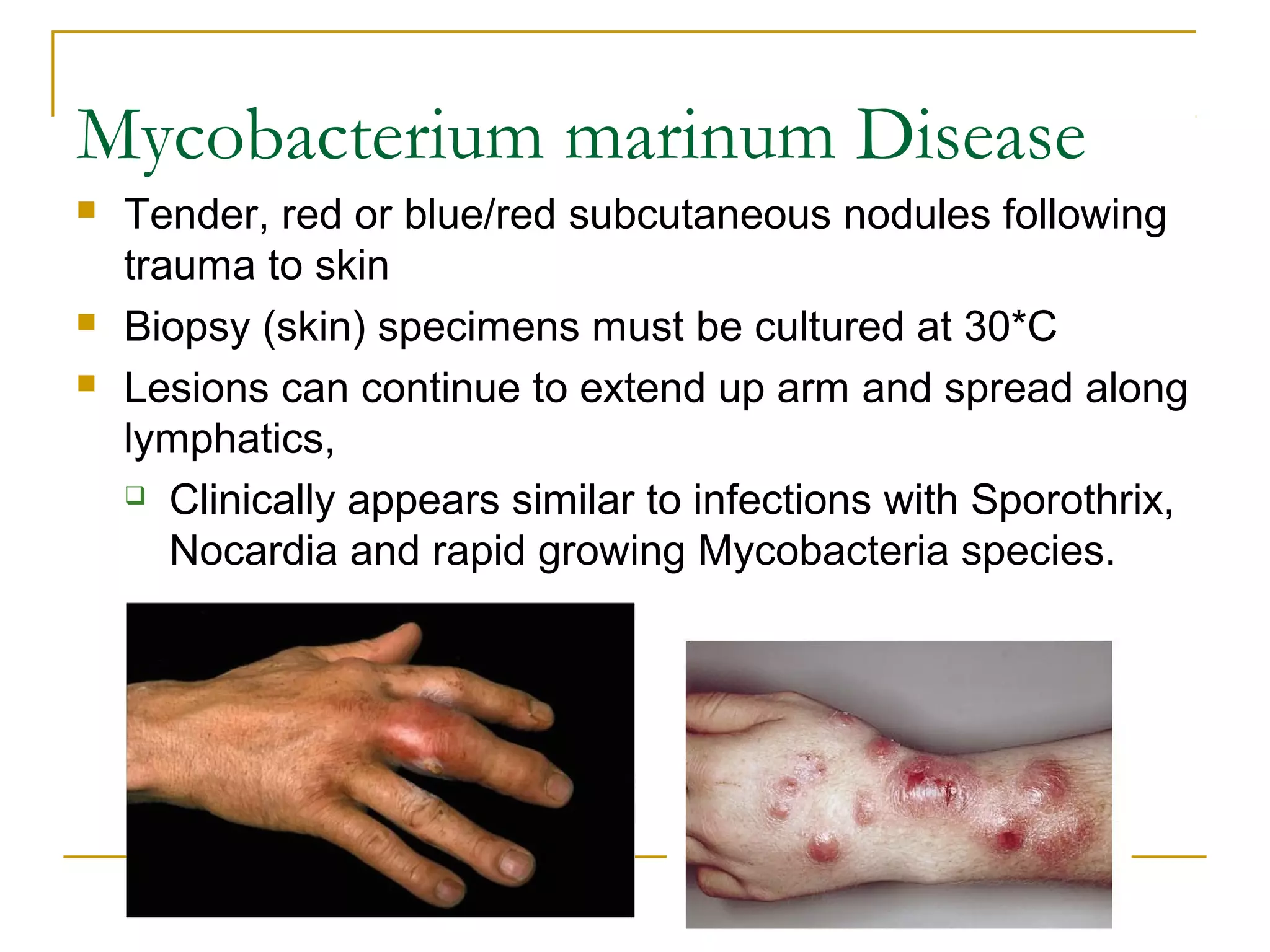 Mycobacteriology 2016 | PPT