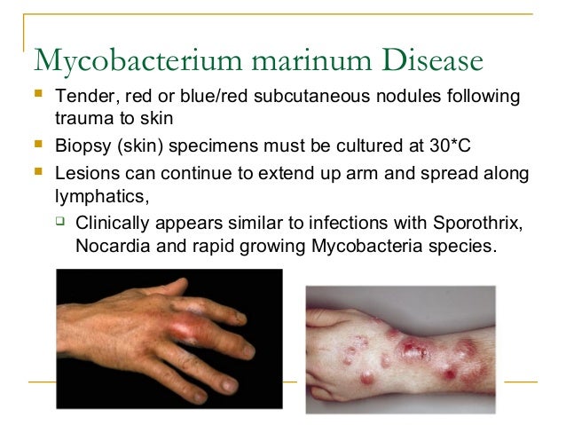 Mycobacteriology 2016