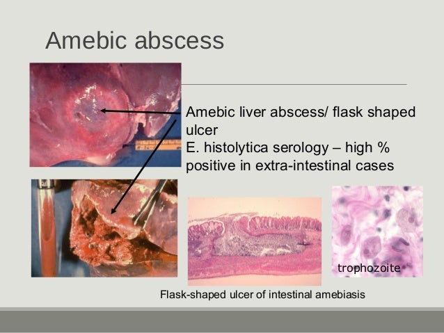 Parasitology Update 2018