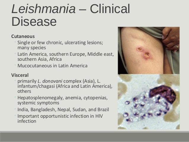Parasitology Update 2018