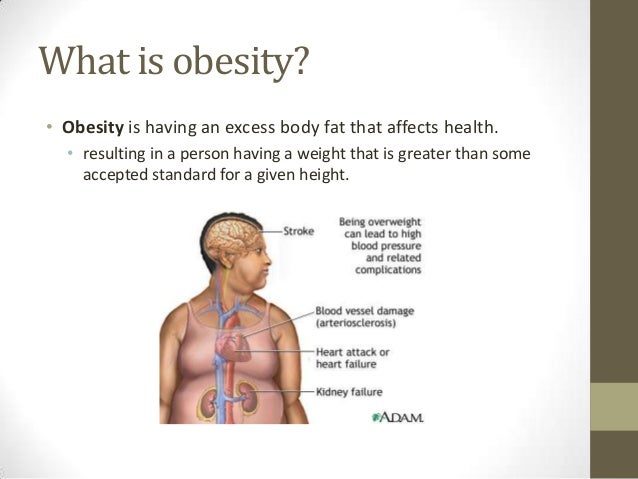 Obesity During Pregnancy Obesity During Pregnancy