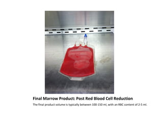 RBC Deplete Marrow | PPT