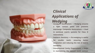 Wedge and Their Technique dental 11.pptx