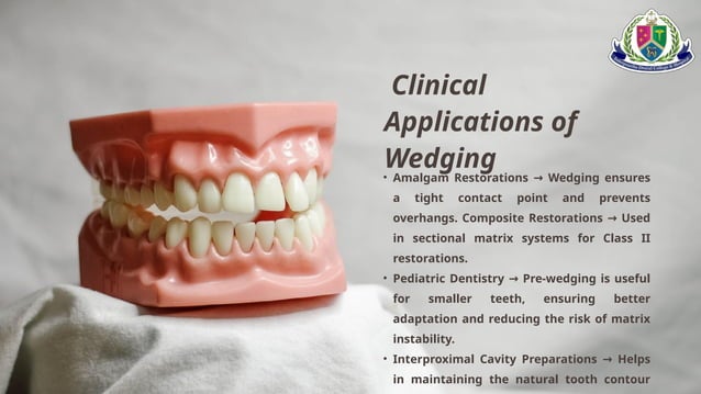 Wedge and Their Technique dental 11.pptx