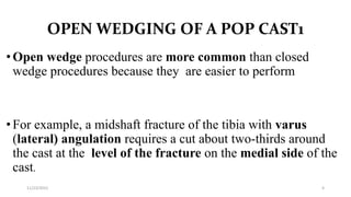 Wedging of pop.pptx