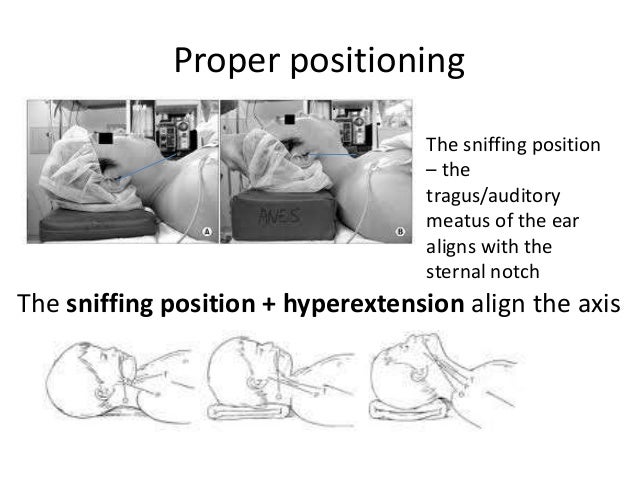 Week 12 airway management