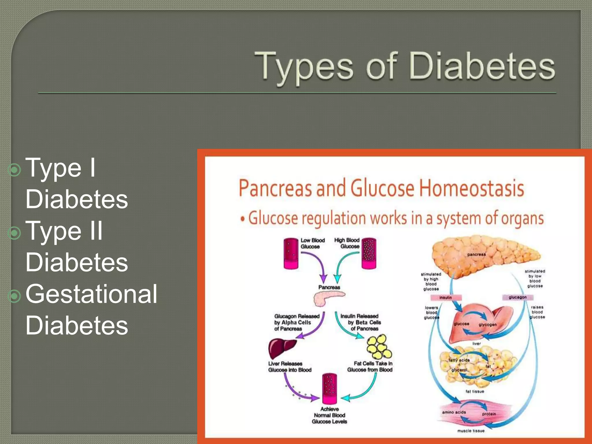 Informative PowerPoint: Managing Diabetes | PPTX