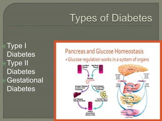 Informative PowerPoint: Managing Diabetes | PPTX