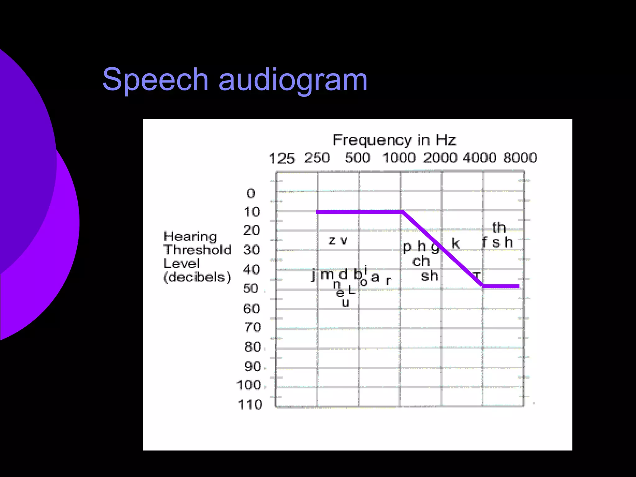 Speech acoustics | PPTX