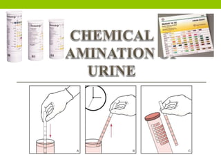 Week3 physical examination of urine | PPTX