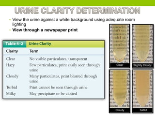 Week3 physical examination of urine | PPTX