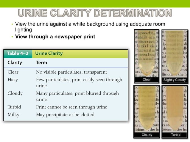 Week3 physical examination of urine | PPTX