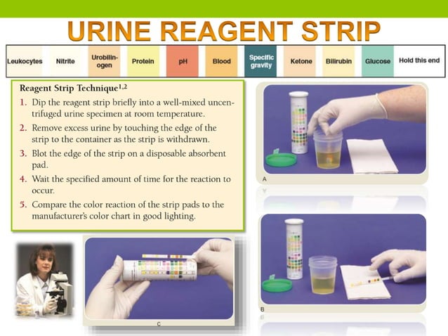 Week3 Physical Examination Of Urine