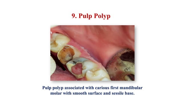 week+3+lect+3+-first+lect+Exophytic+Oral+Lesions.pdf