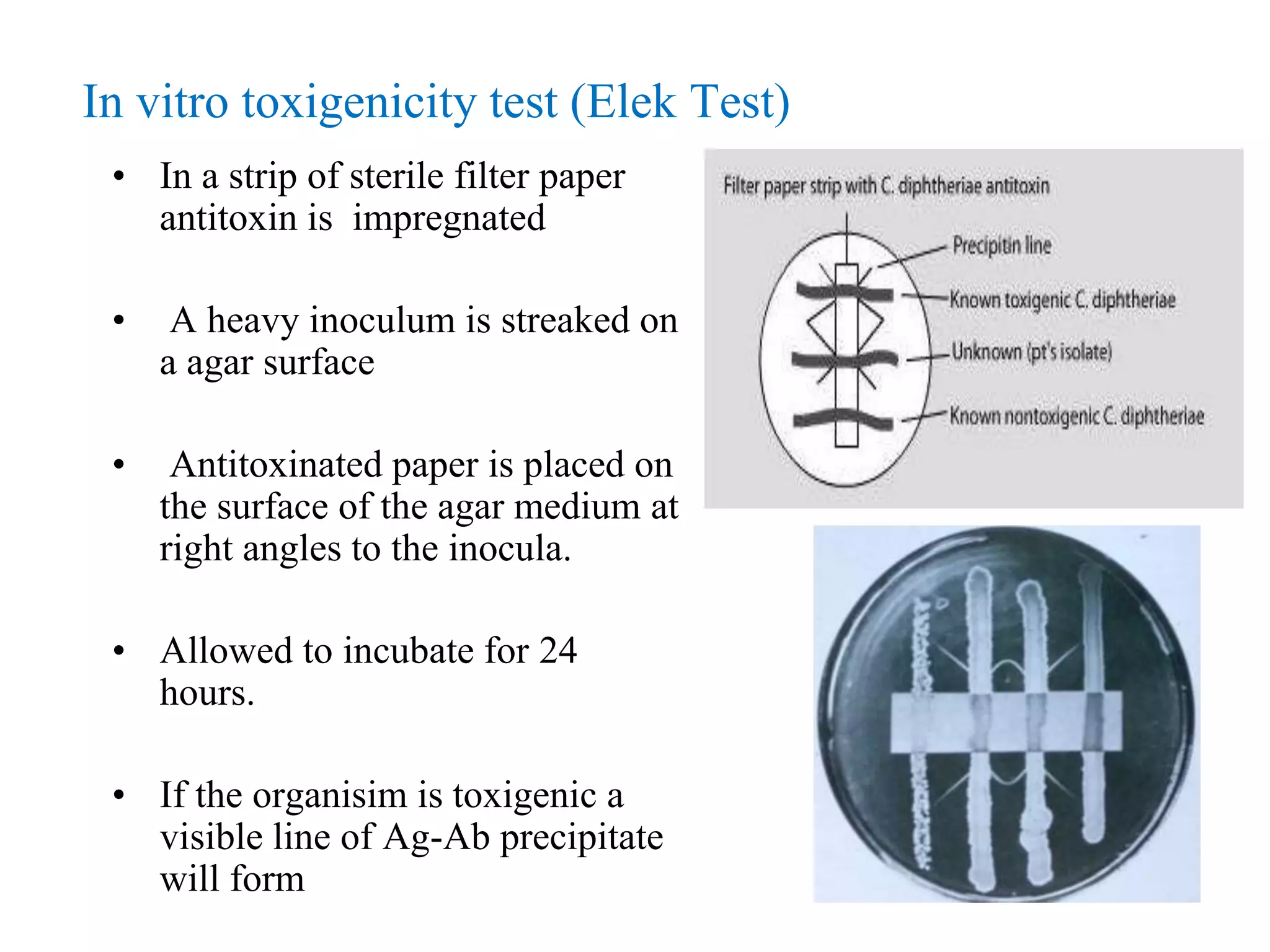 Week 4. Gram Positive Rods.ppt