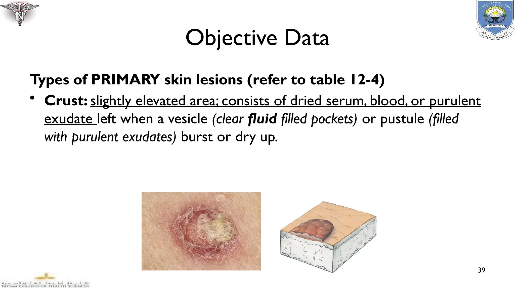 Week 4 CHA Integumentary Assessment.pptx