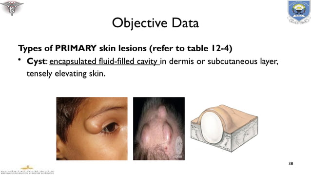 Week 4 CHA Integumentary Assessment.pptx