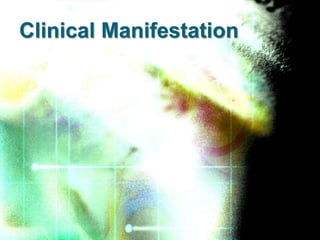 Multiple Organ Dysfunction Syndrome MODS.ppt