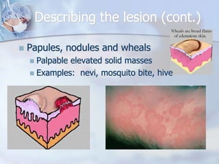 Week 5 Powerpoint for Supplemental Video (skin) | PPT