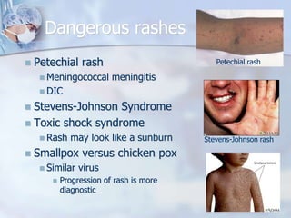 Week 5 Powerpoint for Supplemental Video (skin) | PPTX | Skin and ...