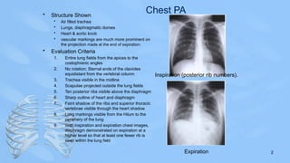 Comprehensive Radiographic Anatomy of the Chest and Heart Structures | PPSX