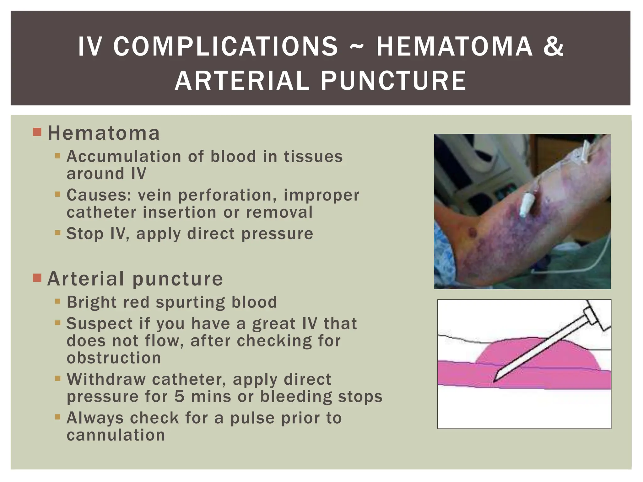 Intravenous Fluids and Drug Calculations | PPT