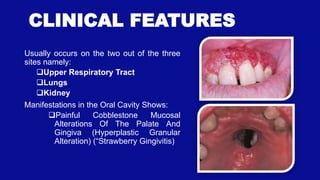 WEGENER’S GRANULOMATOSIS (GRANULOMATOSIS WITH POLYANGIITIS).pptx