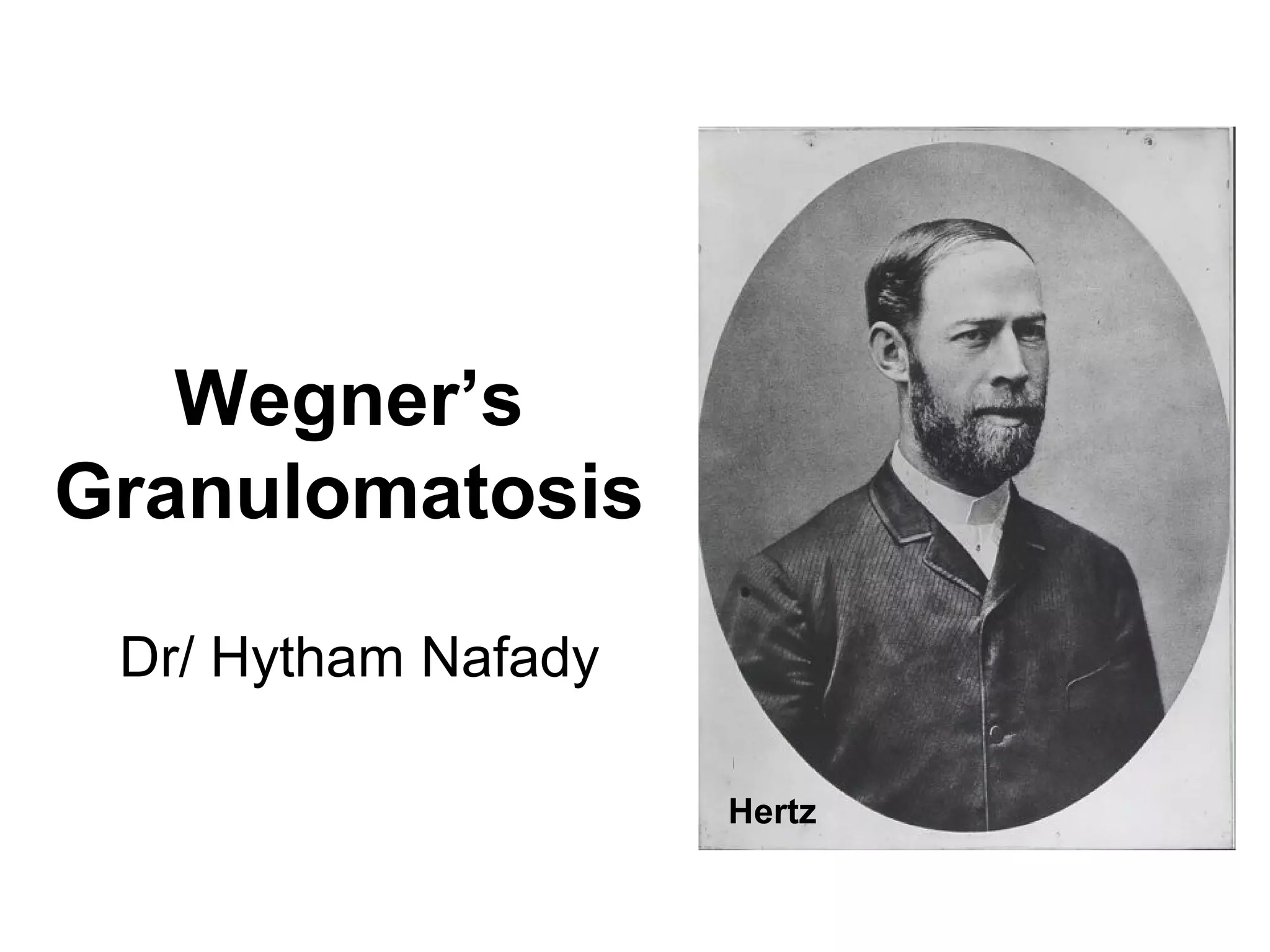 Wegner's granulomatosis | PPT