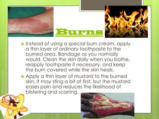 Weird home remedies | PPT