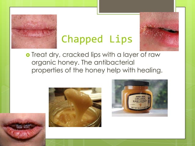 Weird home remedies | PPT | Free Download