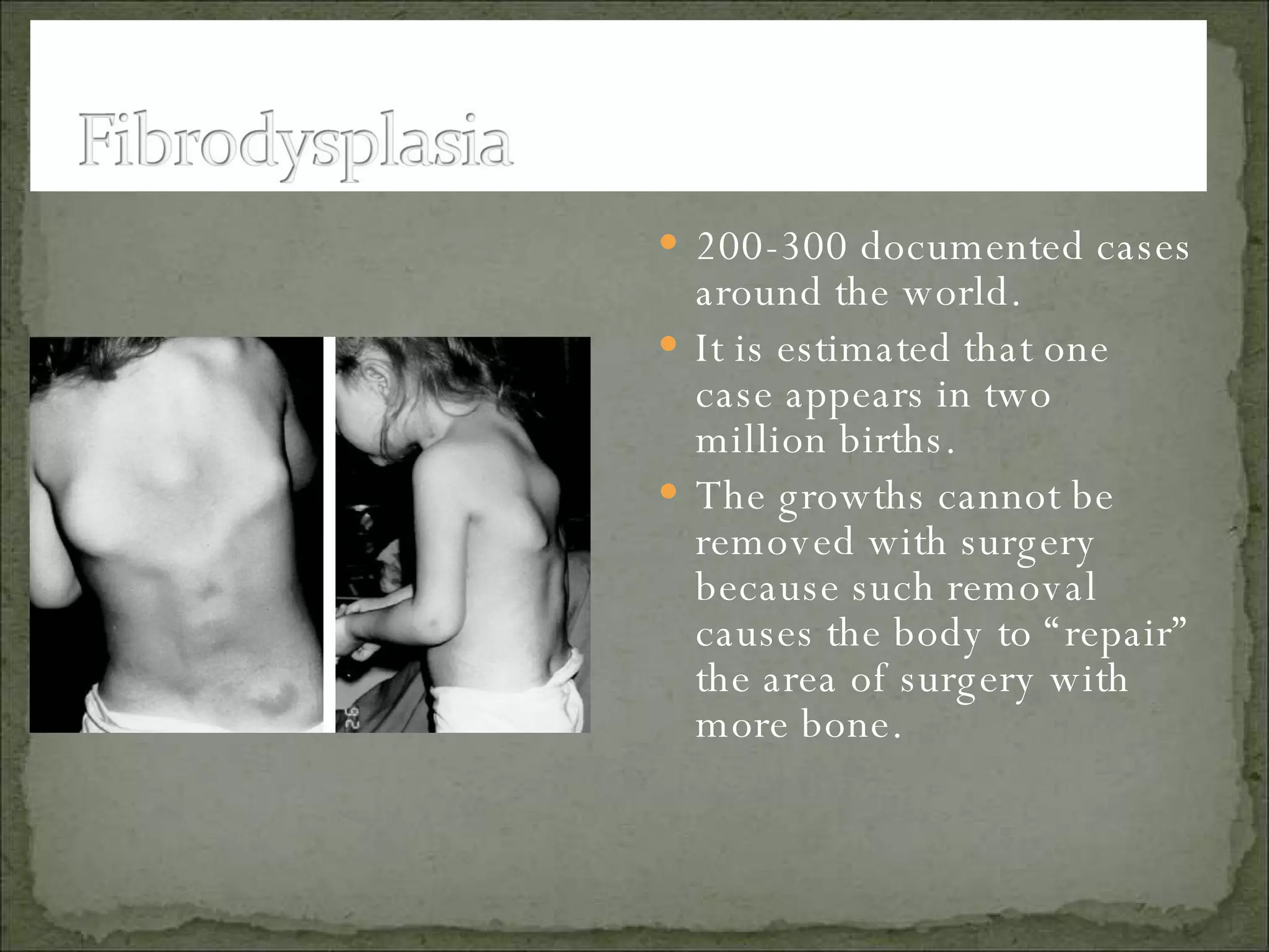 Weird Diseases | PPT