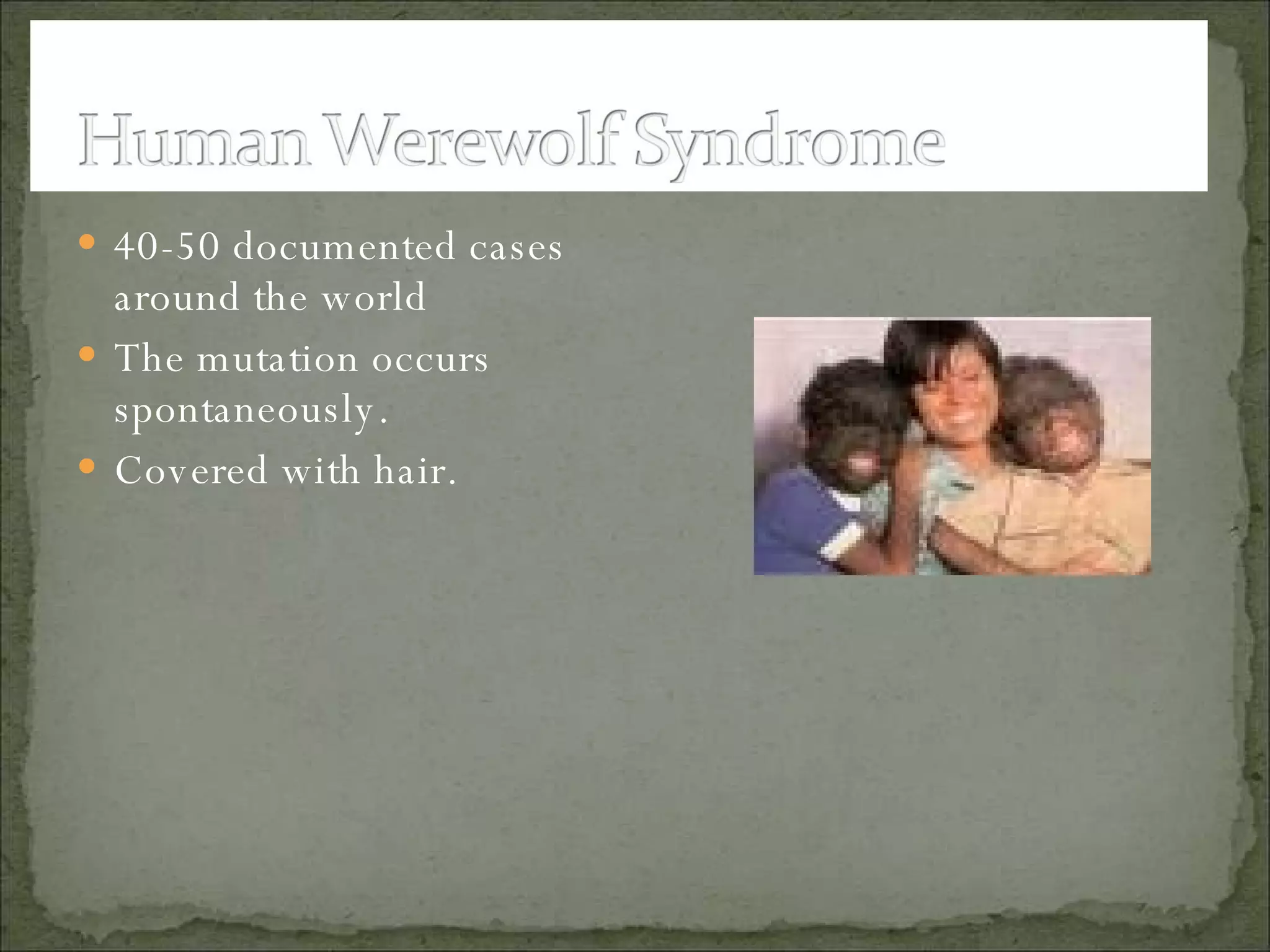 Weird Diseases | PPT