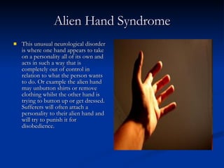 Weird diseases | PPT | Brain and Nervous System Disorders | Diseases ...