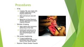 TalipesEquinoVarus.pptx