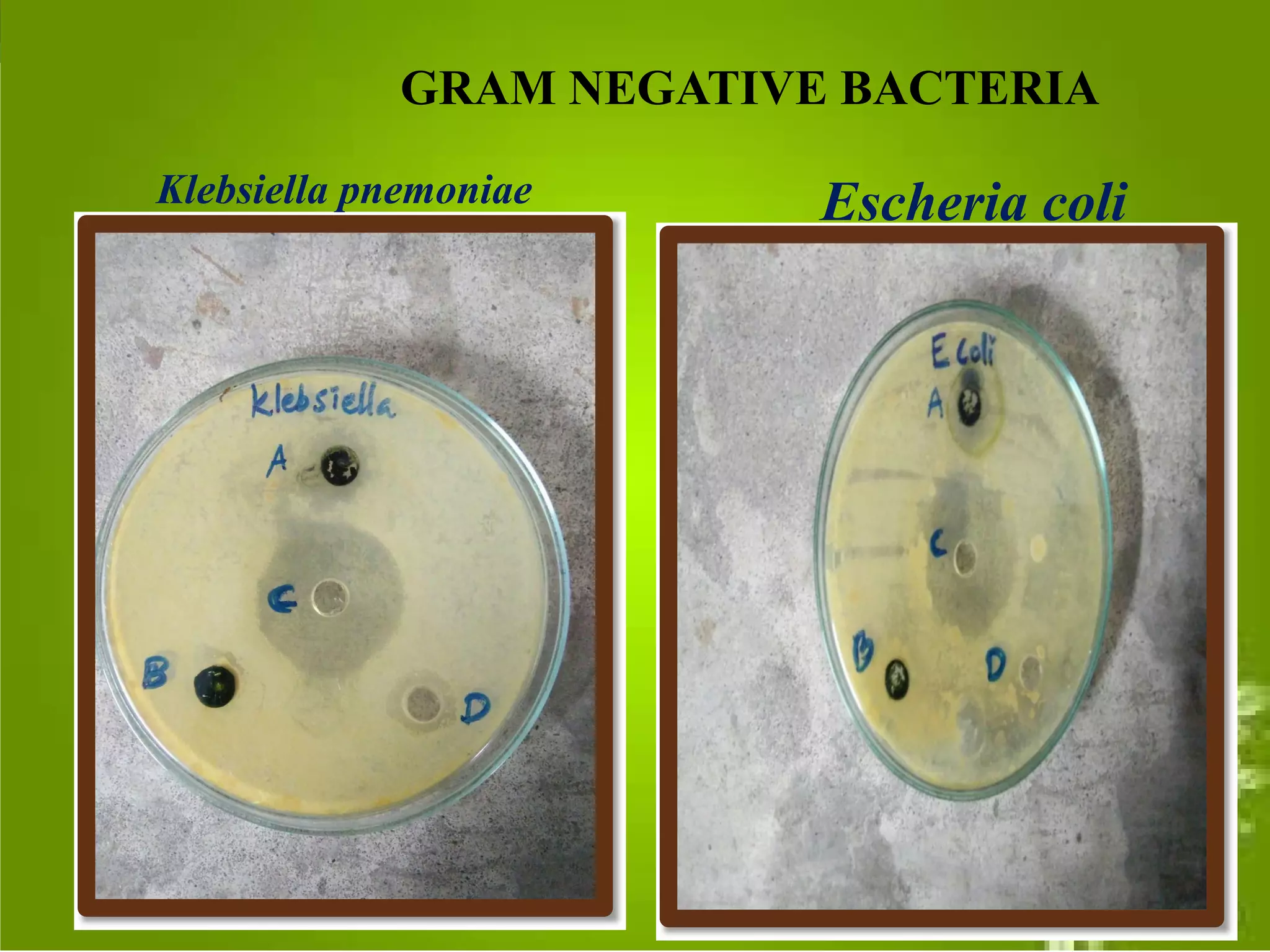 PHYTOCHEMICAL ANALYSIS AND ANTIBACTERIAL ACTIVITY OF LEAVES EXTRACT ...