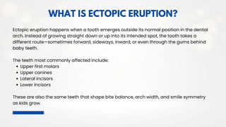 Ectopic Eruption: Why Some Teeth Grow in the Wrong Place | PDF