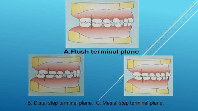 Oral screen and mixed dentition appliance | PPTX | Dental Health ...