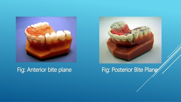 Oral screen and mixed dentition appliance