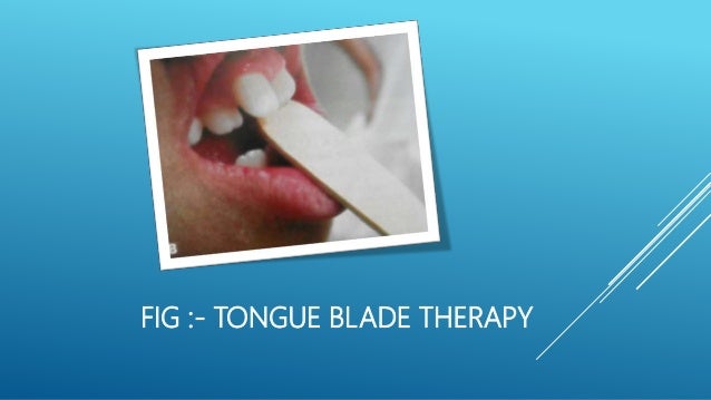 Oral screen and mixed dentition appliance