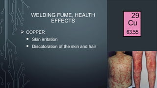 Welding fume risk solution | PDF