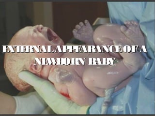 Well born baby | PPT