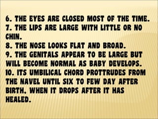 Well born baby | PPT
