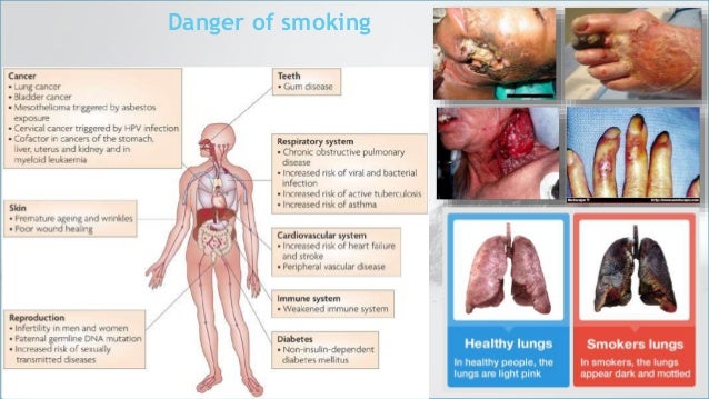 danger of smoking