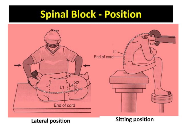 wellcom to anesthesia.pptx