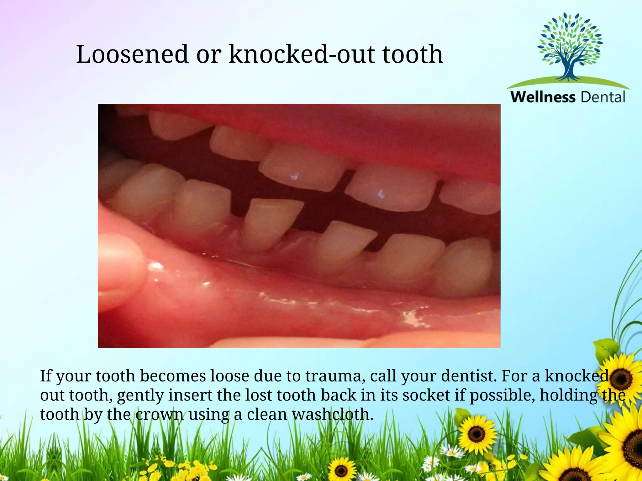 Wellness dental | PDF